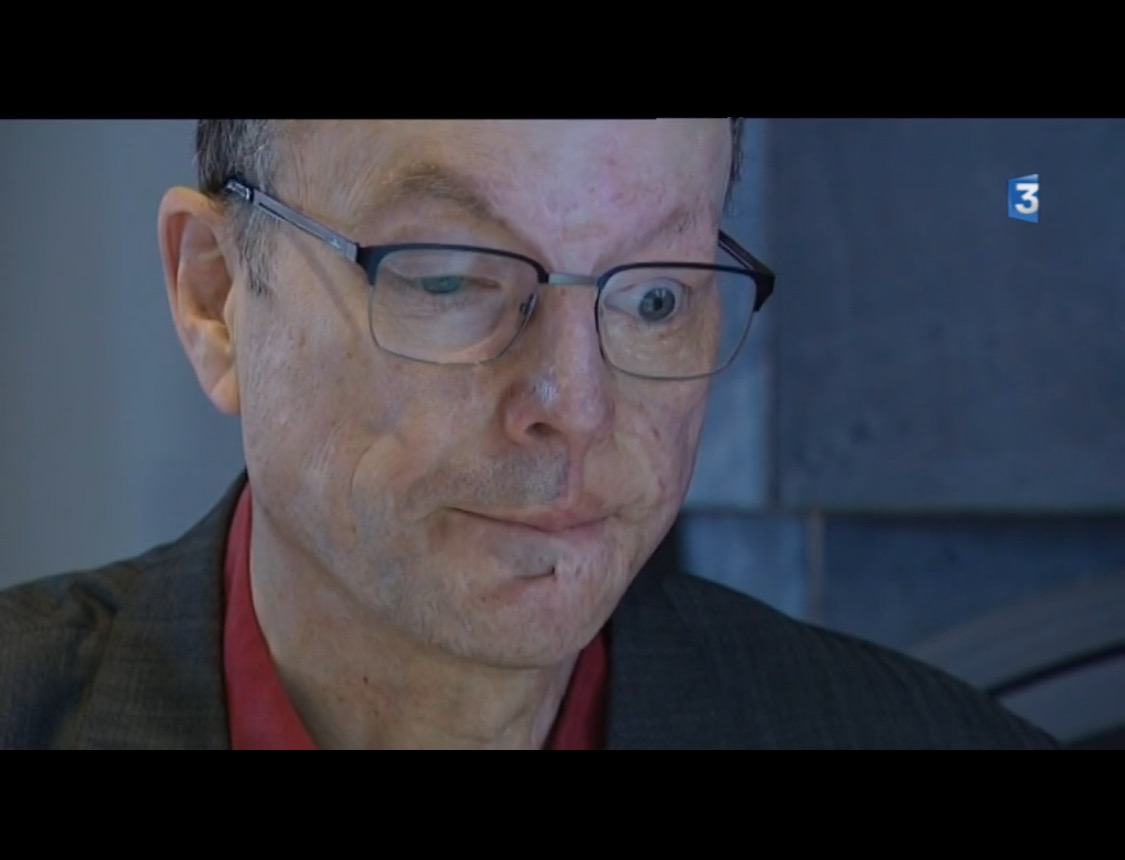 Stella Dimoko Korkus.com: Pascal Meyer -Bathed With Acid In Lagos But 5 ...