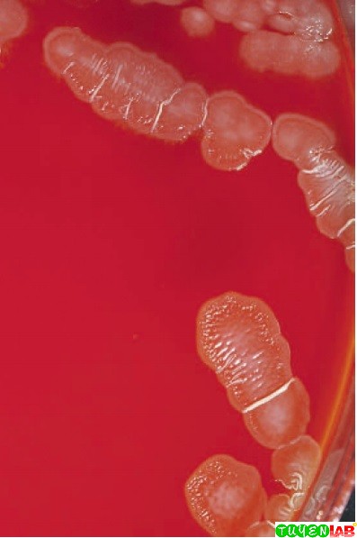 [Microbiology] Atlas of Nonfermenting and Miscellaneous Gram-Negative ...