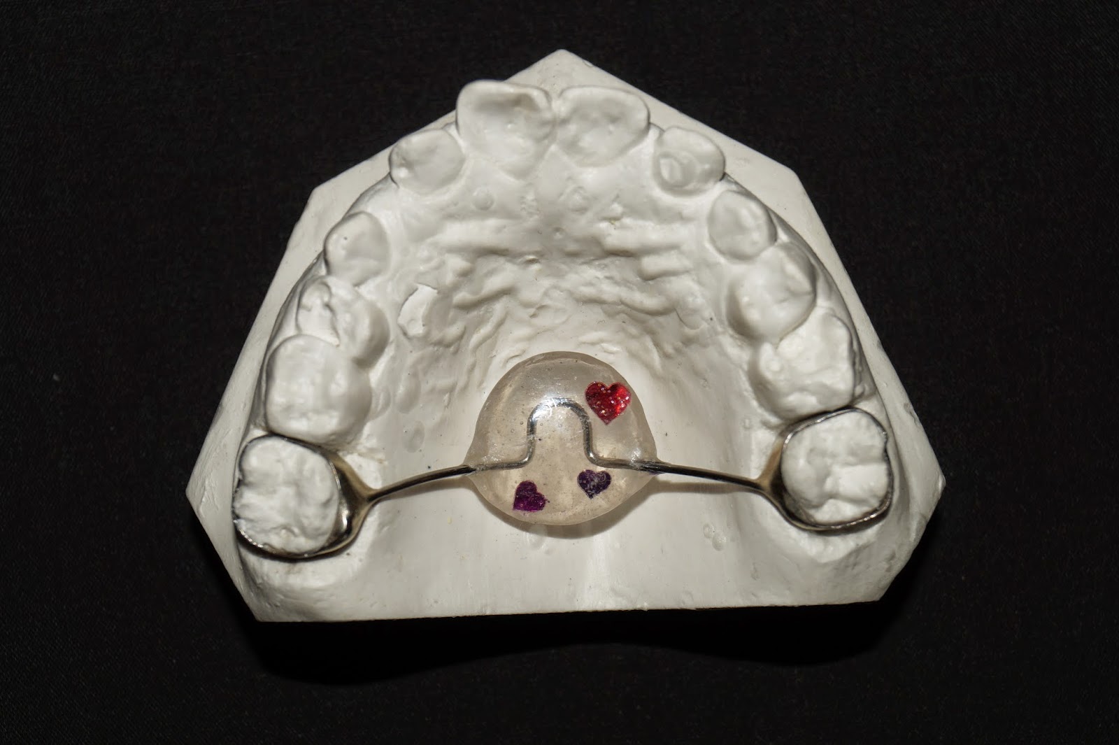 V OPEN LAB : ATP con botón. de intrusión