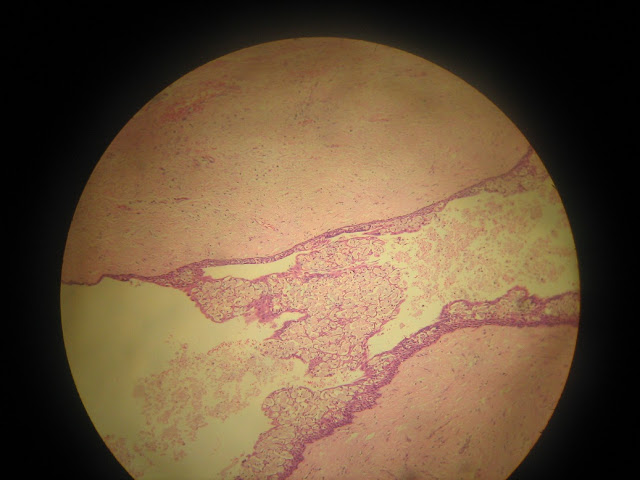 Dentistry and Medicine: Cysts in the mouth and jaws with histologic Slides