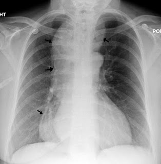 Case of the Day: AAA