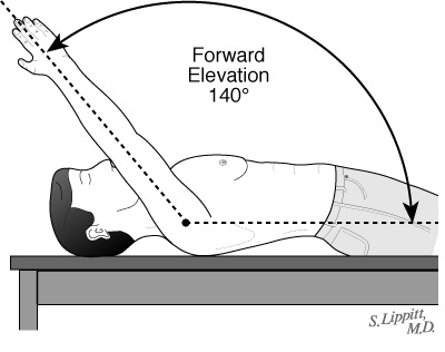 UW Shoulder and Elbow Academy: Stretching - a key to recovery in ...