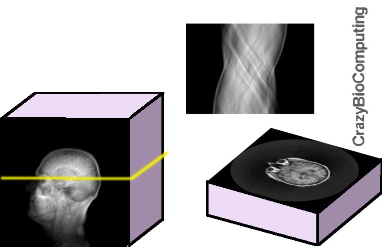 crazybiocomputing: Learning Tomography: Where are the sinograms?