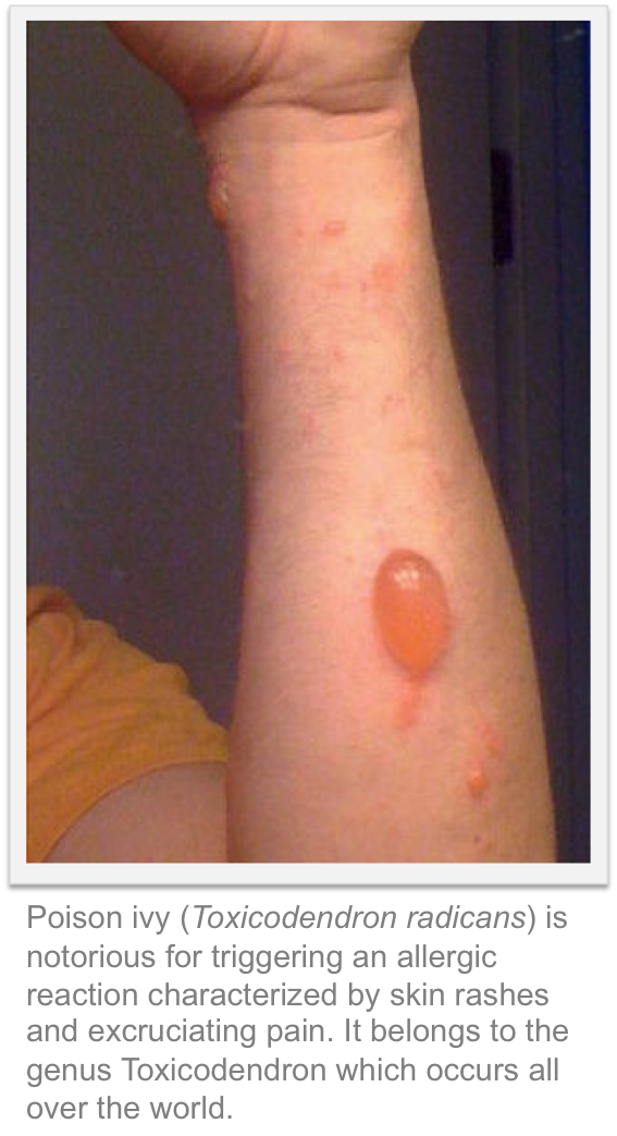 Writer Shack | Joseph Mapue: Greenhouse Gas and Poison Ivy: Rash ...