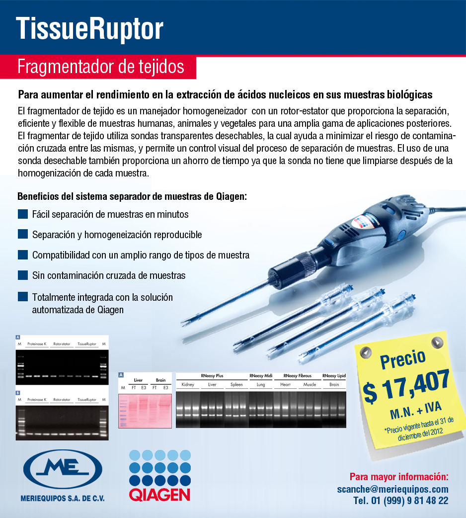 Meriequipos S.A. de C.V.: TissueRuptor de Qiagen