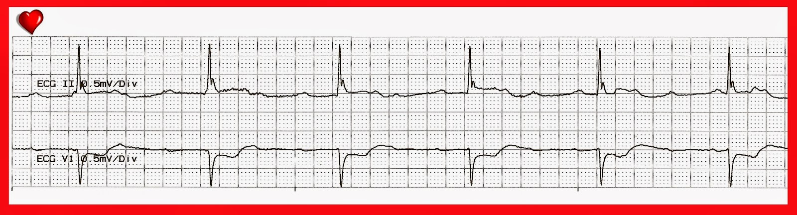 Practice EKG Strips 432
