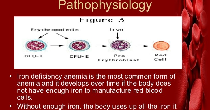 Common Types of Anemia