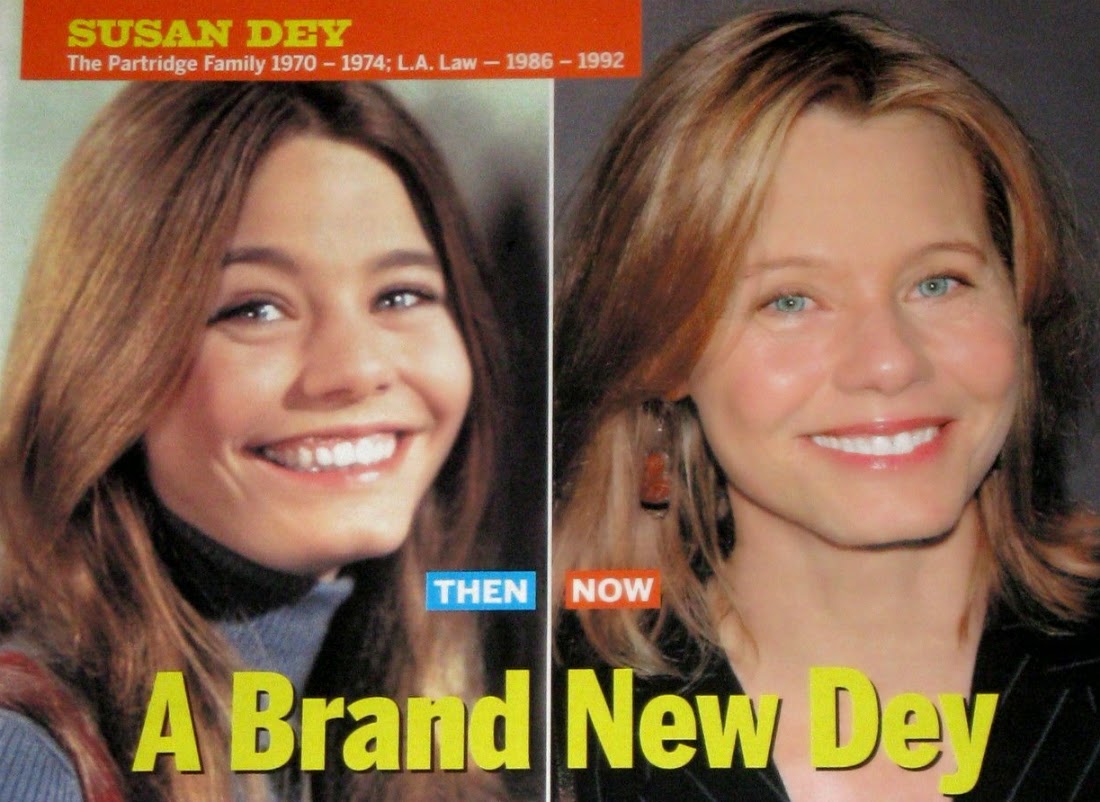 Susan Dey Partridge Family