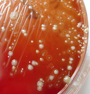 Z Mikrobiologią za Pan Brat: Gardnerella vaginalis w gardle?