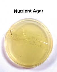 Nutrient Agar - Composition and bacteria cultured - Important Culture ...