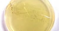 Nutrient Agar - Composition and bacteria cultured - Important Culture Media