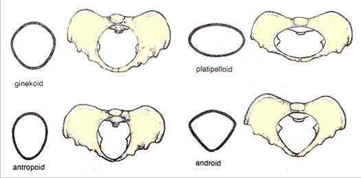 Qhy it'S MinE: PANGGUL