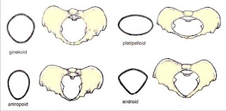 Qhy it'S MinE: PANGGUL
