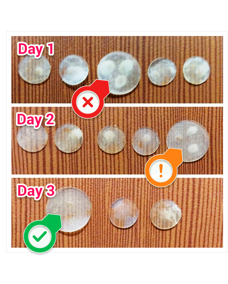 My Learning Journey: Review: 3M NexCare Acne Patch