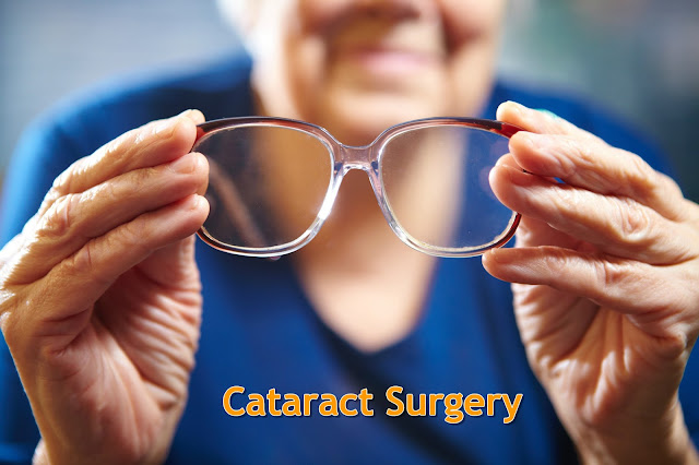 How Soon Can I Wear Eye Makeup After Cataract Surgery?