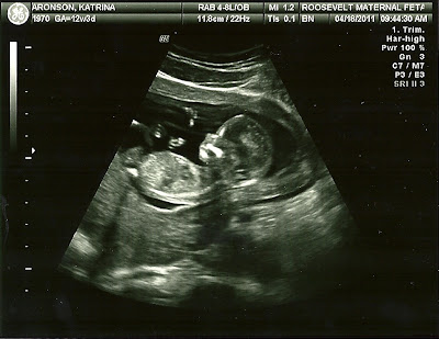 pregnantista: hospital sonogram (nuchal translucency) - 13 weeks