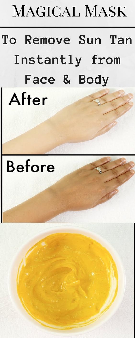 MAGICAL MASK TO REMOVE SUN TAN INSTANTLY FROM FACE & BODY | Health DIY ...