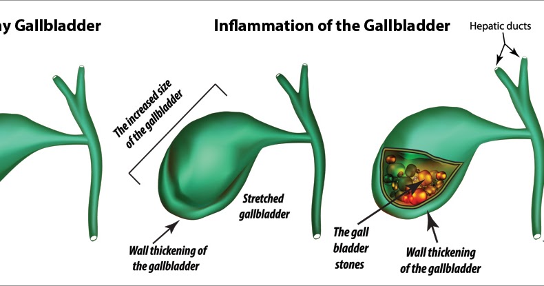 Organ Spotlight: The Gallbladder