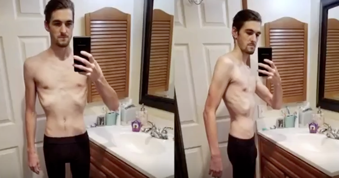 Wounded Times 29 Year Old Veteran Starving While VA Delayed Treatment wounded-times-29-year-old-veteran-starving-while-va-delayed-treatment