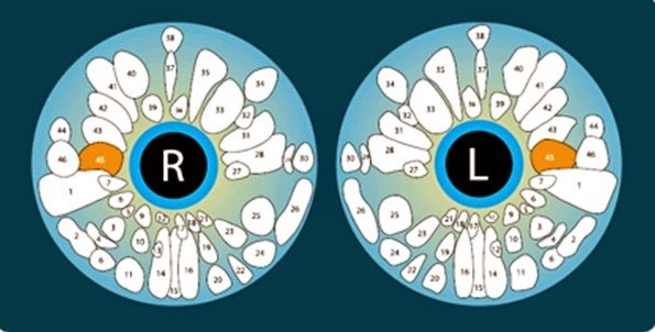 Mauro de Almeida - Iridologia - Iridologie - Iridology.: Um olhar ...