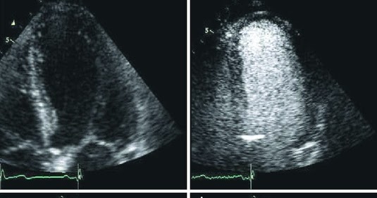 CVT Mohd Farid: The Sonographer Attachment Programme At USA Report ...