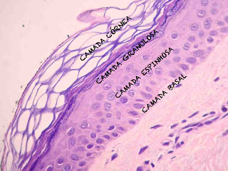 dermatopatologia para iniciantes: EPIDERME E ZONA DE MEMBRANA BASAL