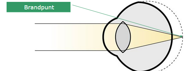 Klassite biologie derde jaar ASO wetenschappen thema 'het menselijk oog ...