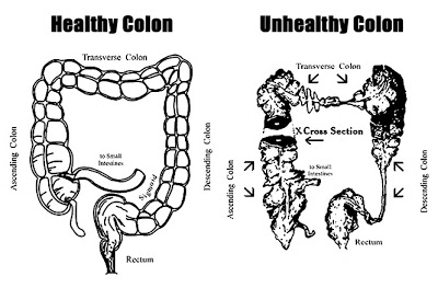 Healing, Anti-Aging, and Yoga: Colon cleansing the best way to get that ...