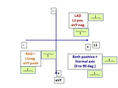 Cardiology AMC KGH Vizag: ECG reading - some practical basics