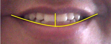 ANALISIS DE SONRISA: ANALISIS DE SONRISA, INTRODUCCION A LA ODONTOLOGIA
