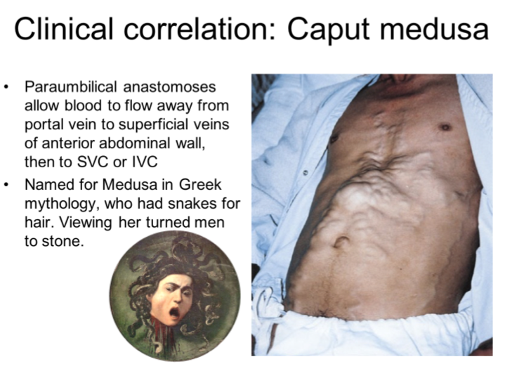 EXAMS AND ME : Caput Medusae