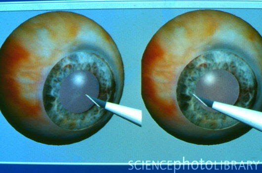 my eyes is the mirror of my heart: Eye examination