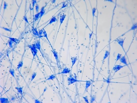 Fun With Microbiology (What's Buggin' You?): Paecilomyces variotii