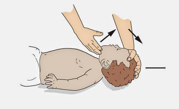 Head Tilt, Chin Lift ~ Nursing