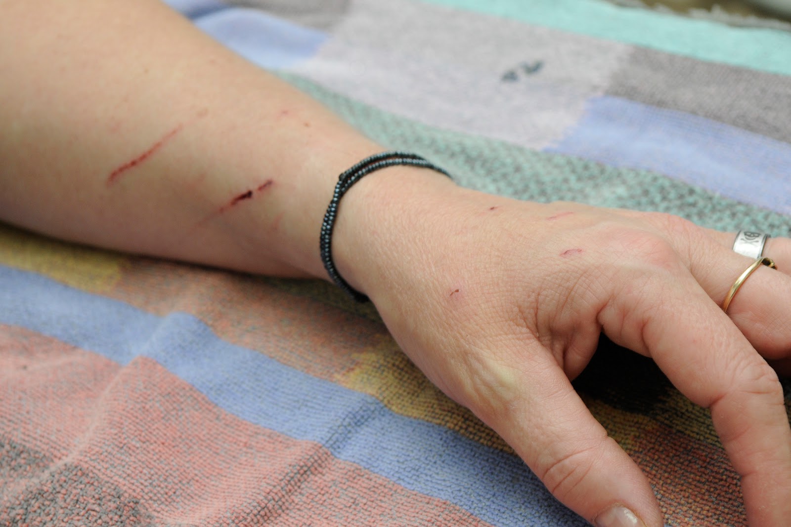 Small Animal Talk: Workplace injuries in the veterinary profession