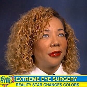 Tiny defends eye colour surgery on GMA... - ~ * Toya'z World