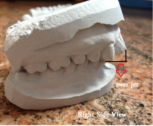 My Journey to LIFE. (previously My Invisalign Diaries)