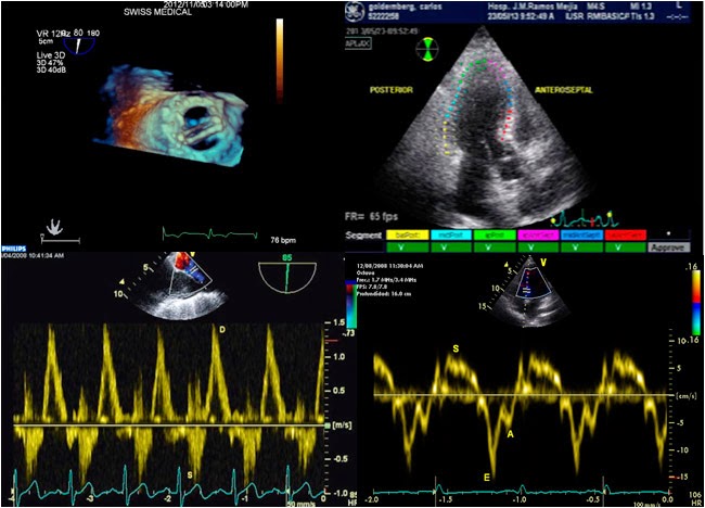 Curso Avanzado de Actualización en Doppler Cardíaco/Nuevas Técnicas ...