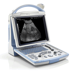 USG portable 2 dimensi - USG Portable