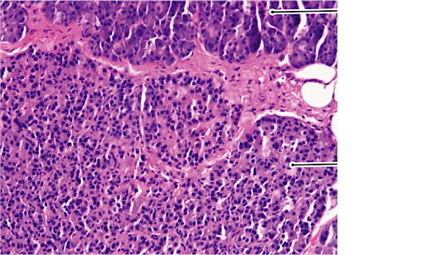 SOS BIOLOGIA CELULAR Y TISULAR: DIGESTIVO. GASTRINOMA