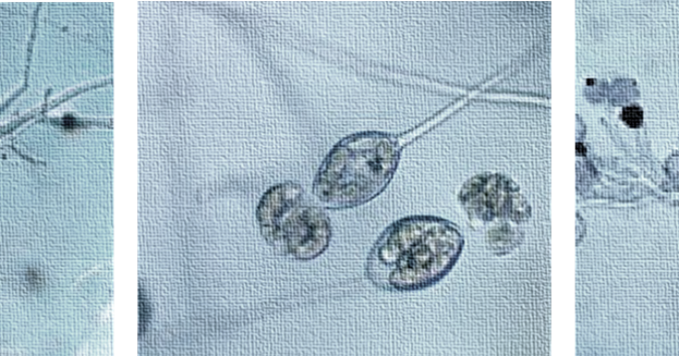 Pengertian Oomycetes, Osifikasi, Oxalidaceae, Papilionaceae