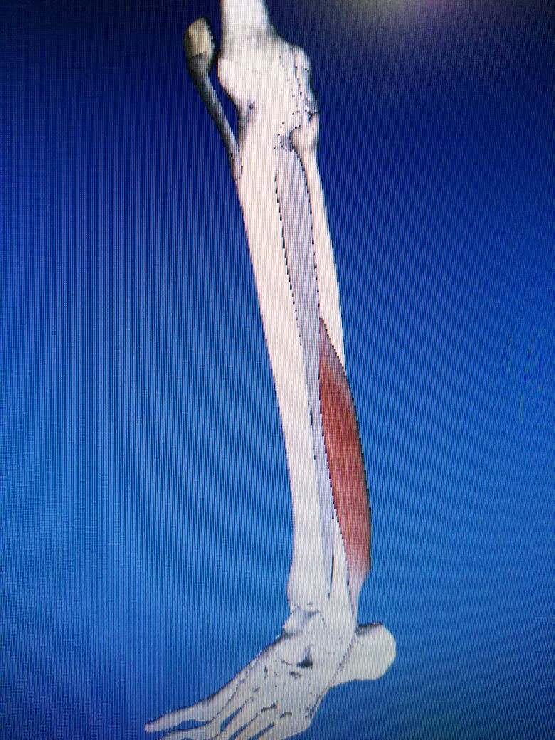 SISTEMA MUSCULO ESQUELETICO: SISTEMA MUSCULAR