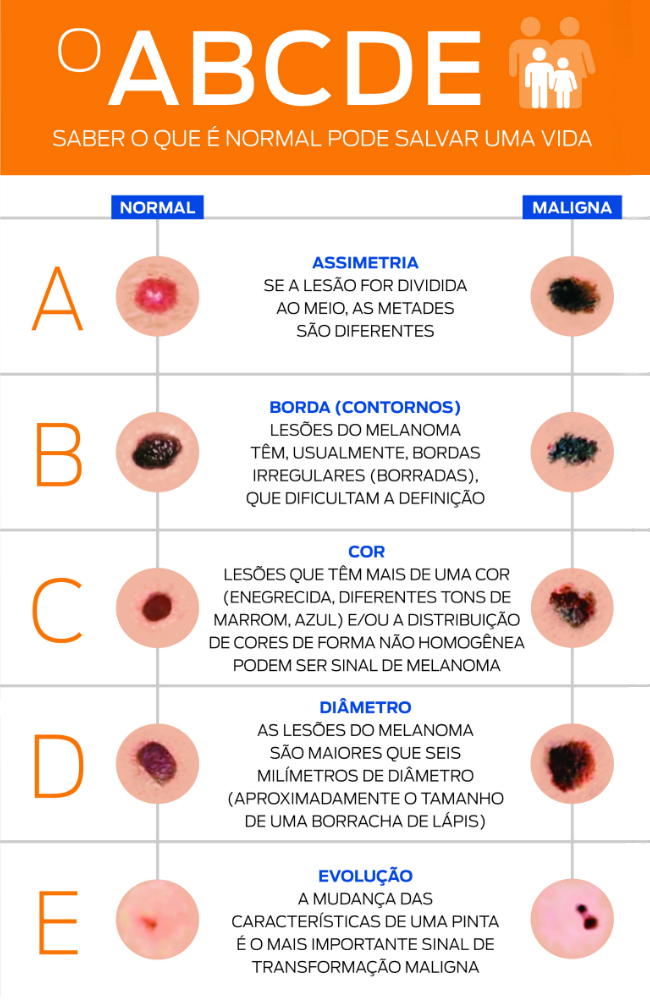 DALVA DAY: * 2016 - Fique atento aos sinais do câncer de pele