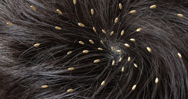 Coffee with the Hermit: Bald For A Good Reason...!