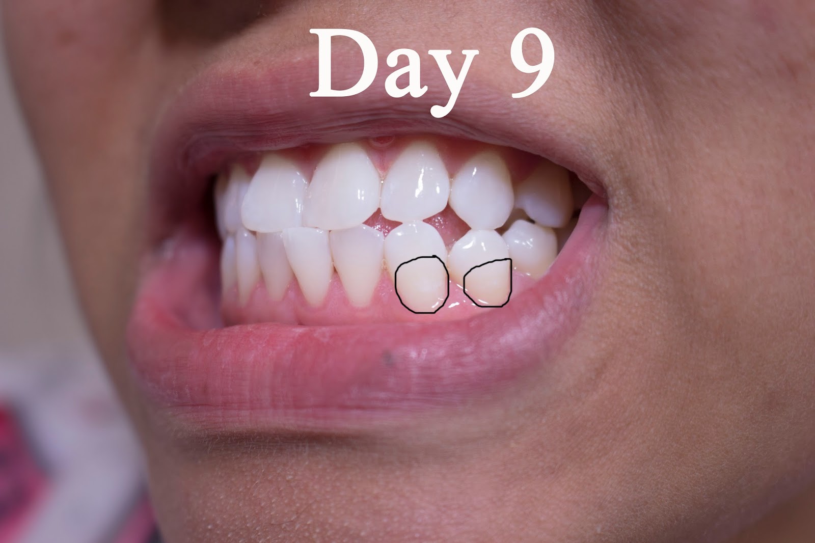 Simply Sovann: At Home Teeth Whitening For Coffee Addict