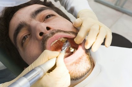 Impacted Wisdom Tooth Removal | Dental Dentist