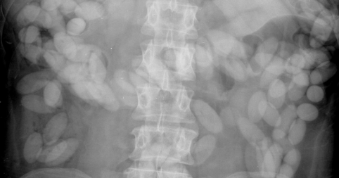 El Baúl Radiológico: LOS RAYOS X, DETECTORES DE DROGA (Detection of ...