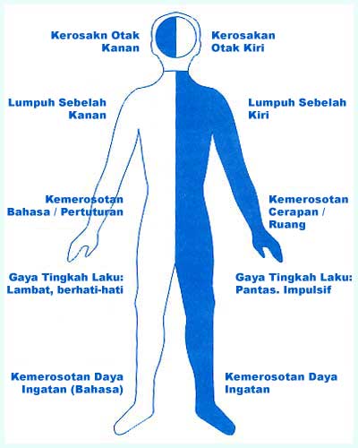 Cara Memulihkan Pesakit Stroke Dengan Pantas Dan Berkesan ~ Cara Hidup ...