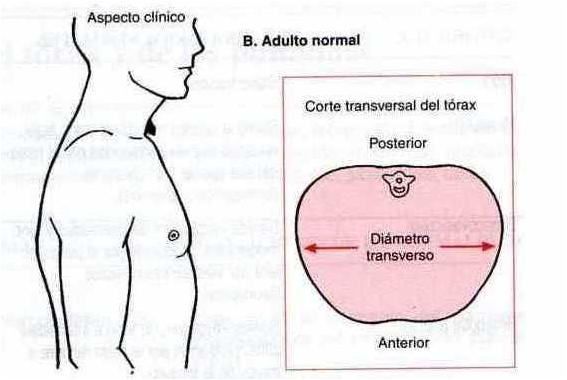 Enfermería Básica UCV : — TORAX ANTEROPOSTERIOR