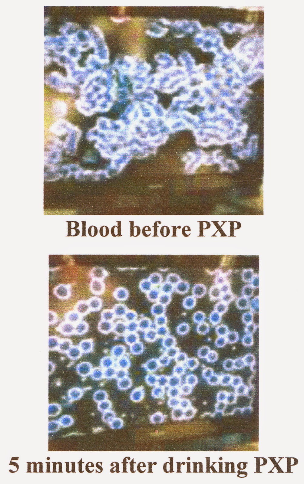 Jean's Enzacta Page: PXP